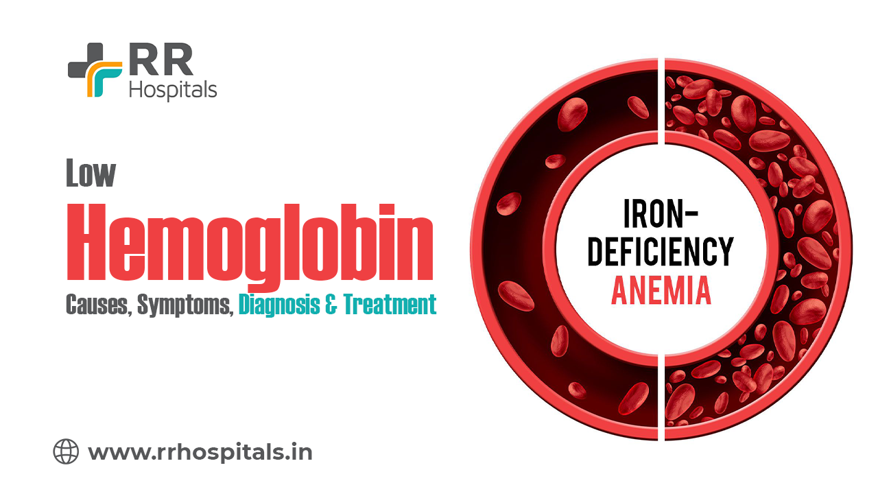 Low Hemoglobin Causes, Symptoms, Diagnosis & Treatment